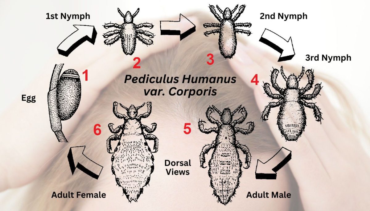 Breaking the Head Lice Life Cycle Infestation for a Family of Five